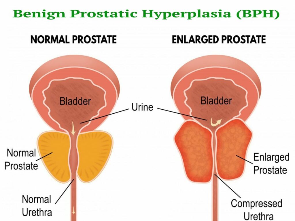 Normal semen parameters - Dr Brojen Barman